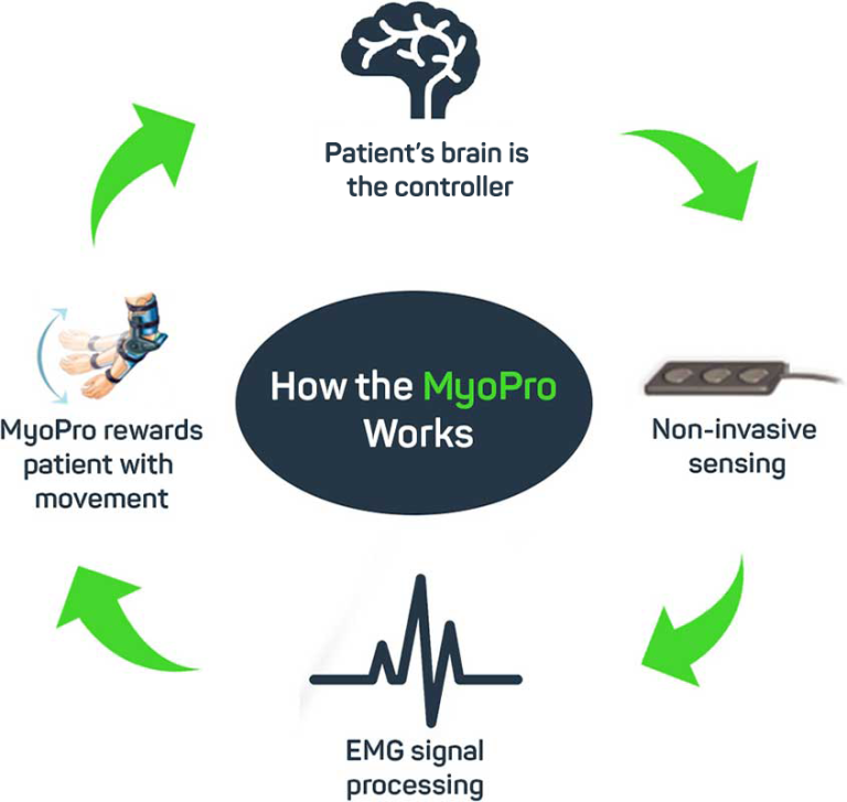 What is A MyoPro Orthosis – Move My Arm Again
